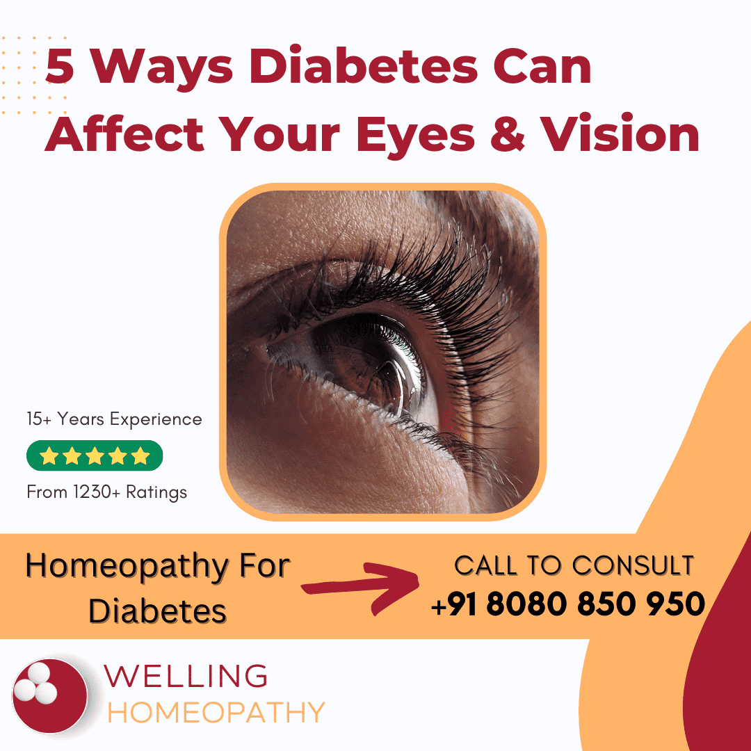 5 Ways Diabetes Can Affect Your Eyes & Vision – Welling Homeopathy